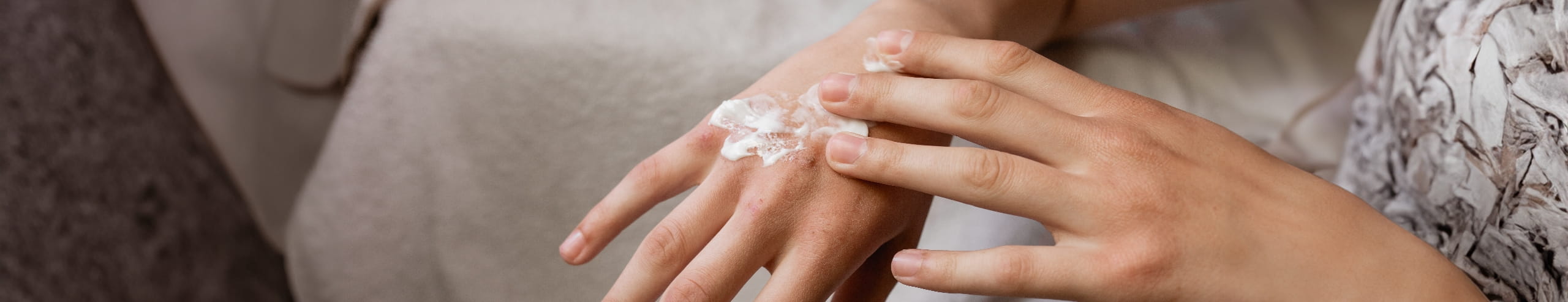 Iritačná kontaktná dermatitída - Sudocrem Slovakia